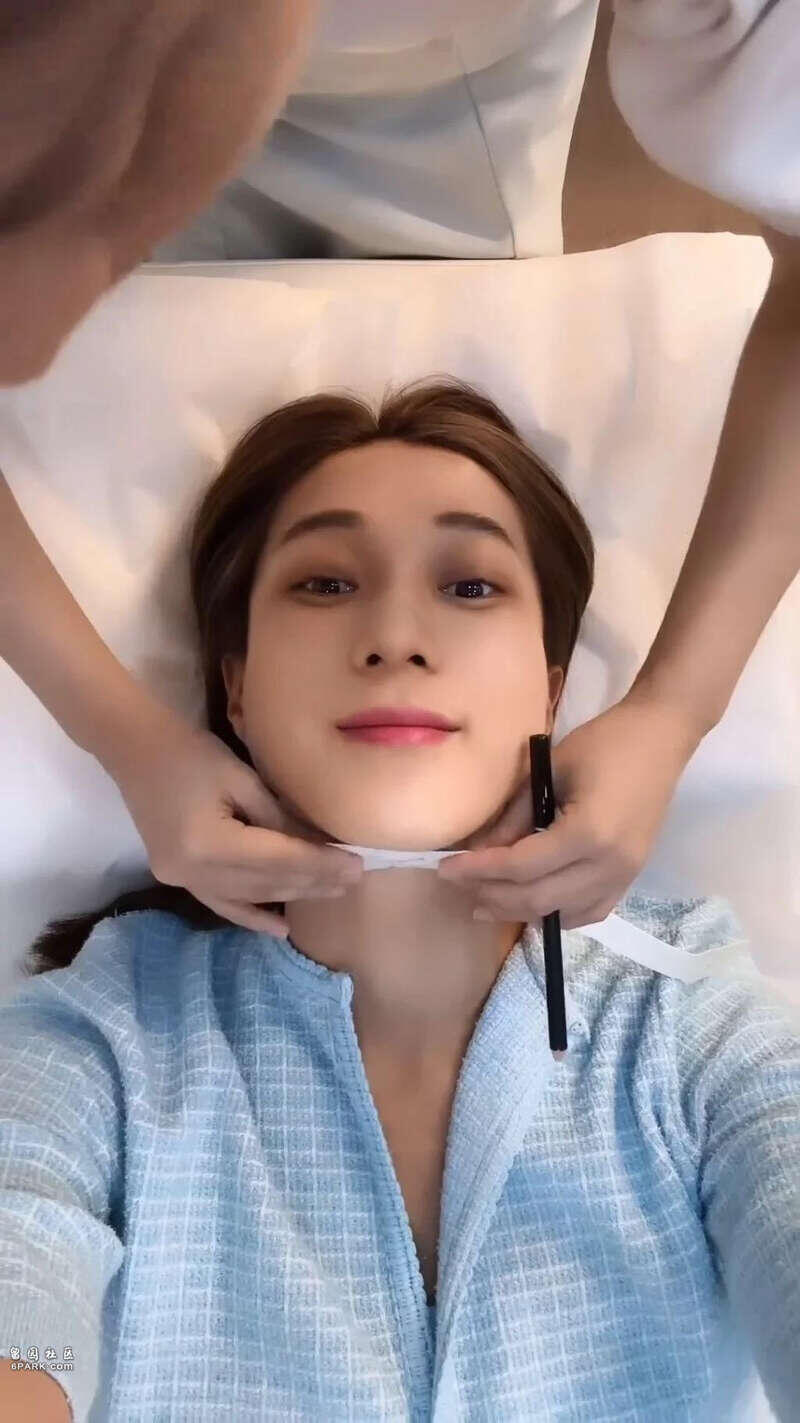 TVB前花旦钟嘉欣直击医美全过程！称为下巴抽脂 - 人在温哥华网 VanPeople.com